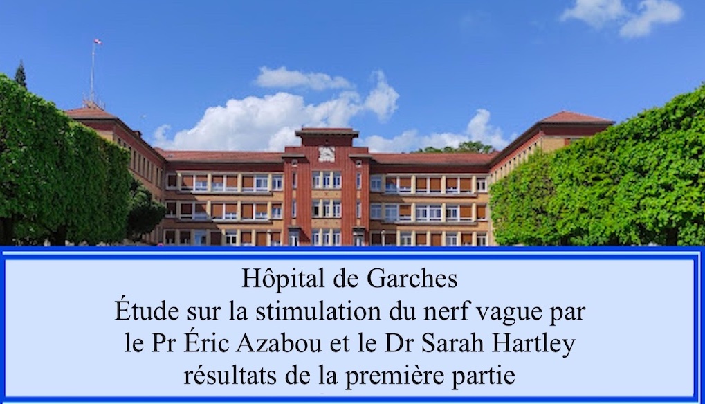 Stimulation Du Nerf Vague Résultat étude Première Partie